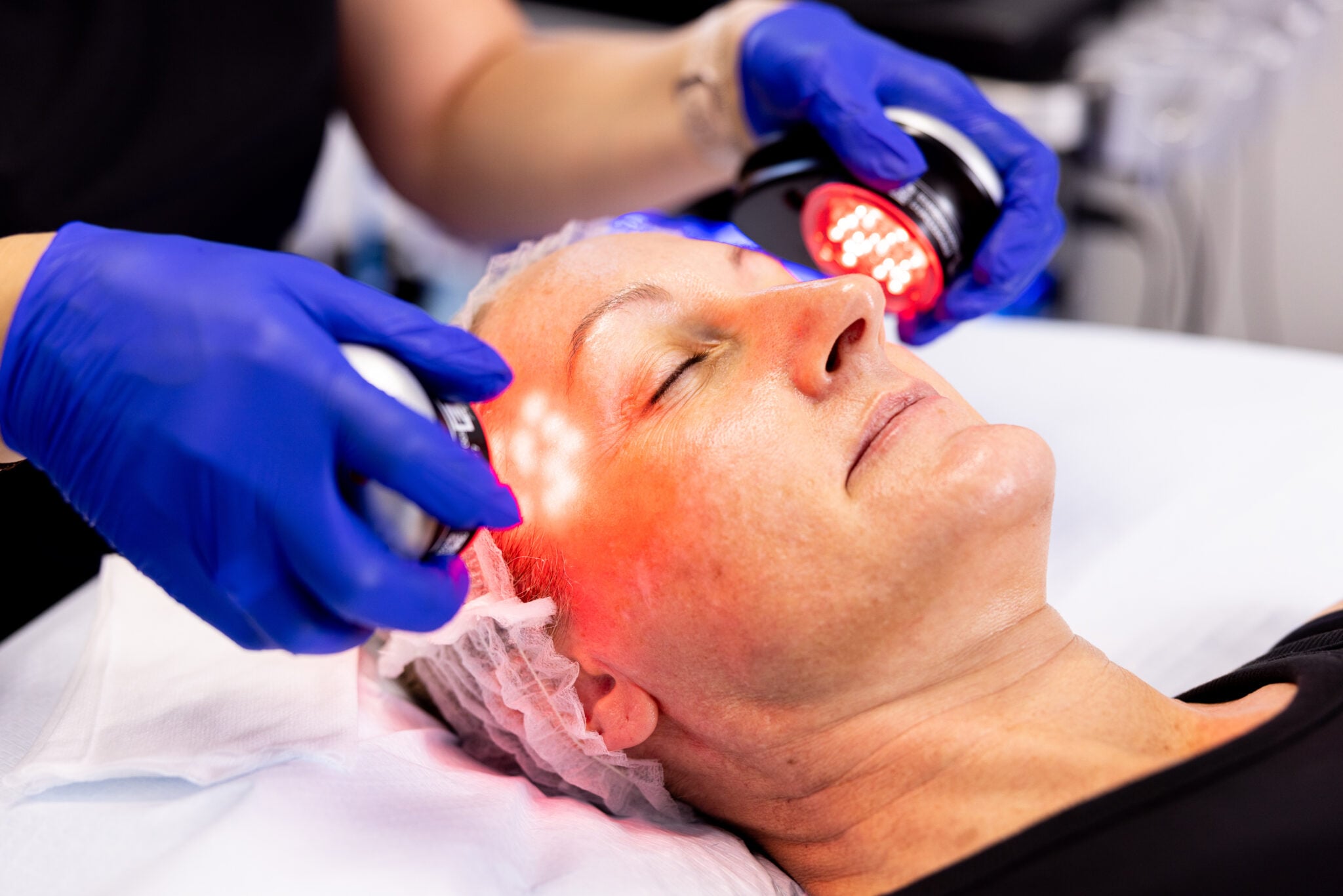 Laser Skin Rejuvenation Sydney | Expert Skin Laser Therapy